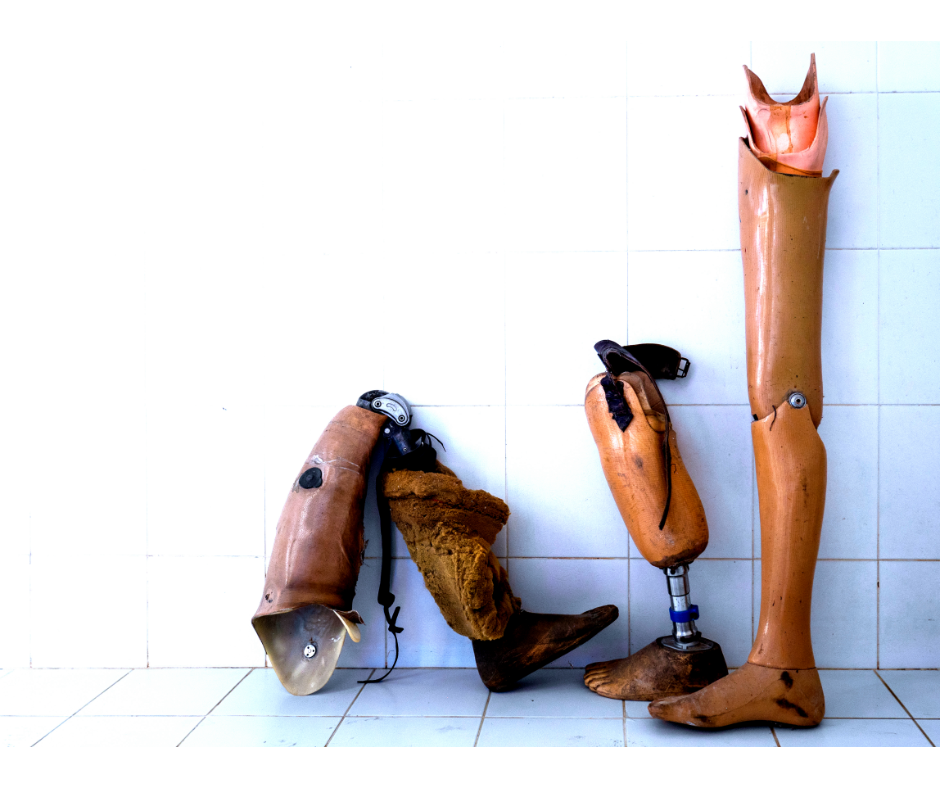 Evolution of Prosthetics: A Millennia-Long Journey of Medical and ...